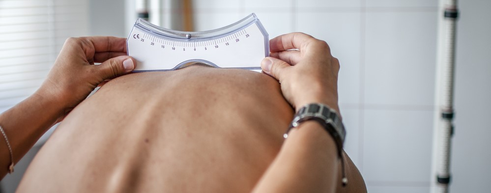 Skoliozė – kreivas stuburas bei kaip sau padėti